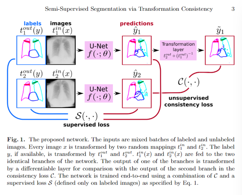 Semi-supervised medical image segmentation via learning consistency under transformations._semi ...