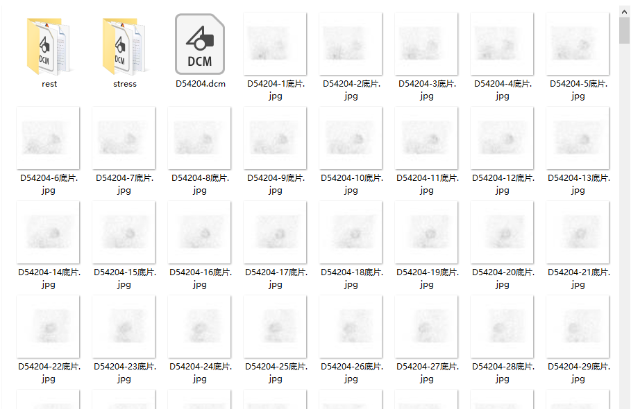 Java提取dicom文件中的多张图片，并进行放大、取反处理_java dicom图浏览修改-CSDN博客
