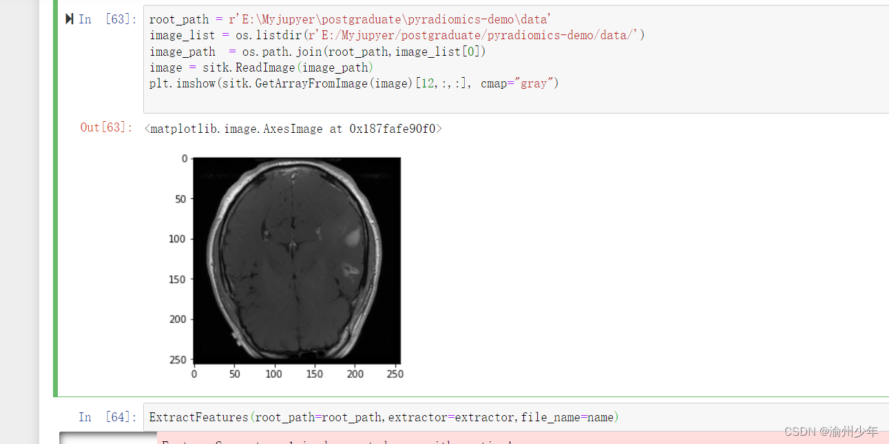 pyradiomics特征提取和保存_this module is used for interaction with pyradiomi-CSDN博客