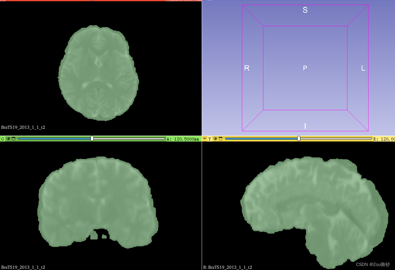3dslicer安装及学习3d Slicer读取nii图像 Csdn博客