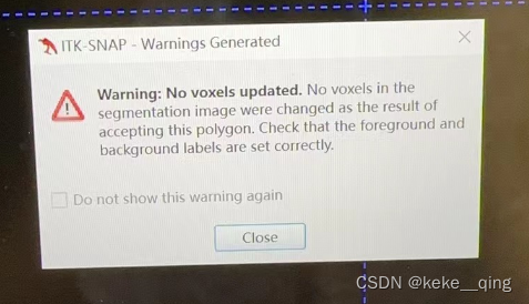 如何利用ITK-SNAP进行ROI（感兴趣区）勾画-CSDN博客