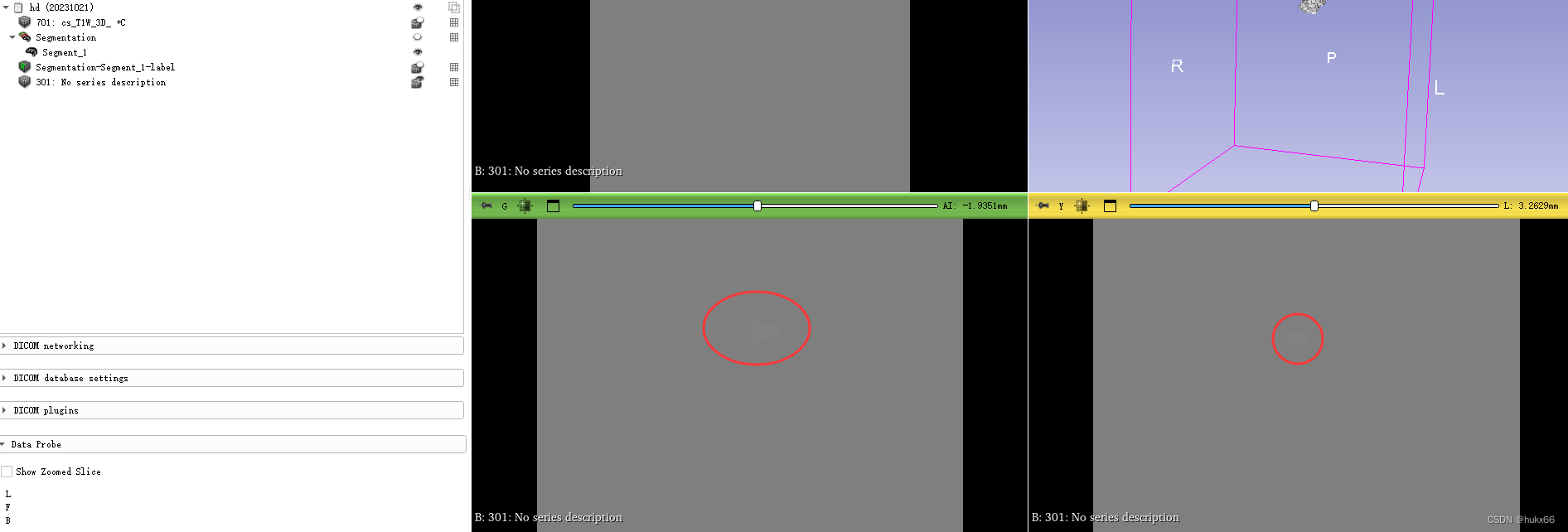 求助 3D slicer 将segmentation导出为 dicom格式_3dslicer导出的是什么样的-CSDN博客