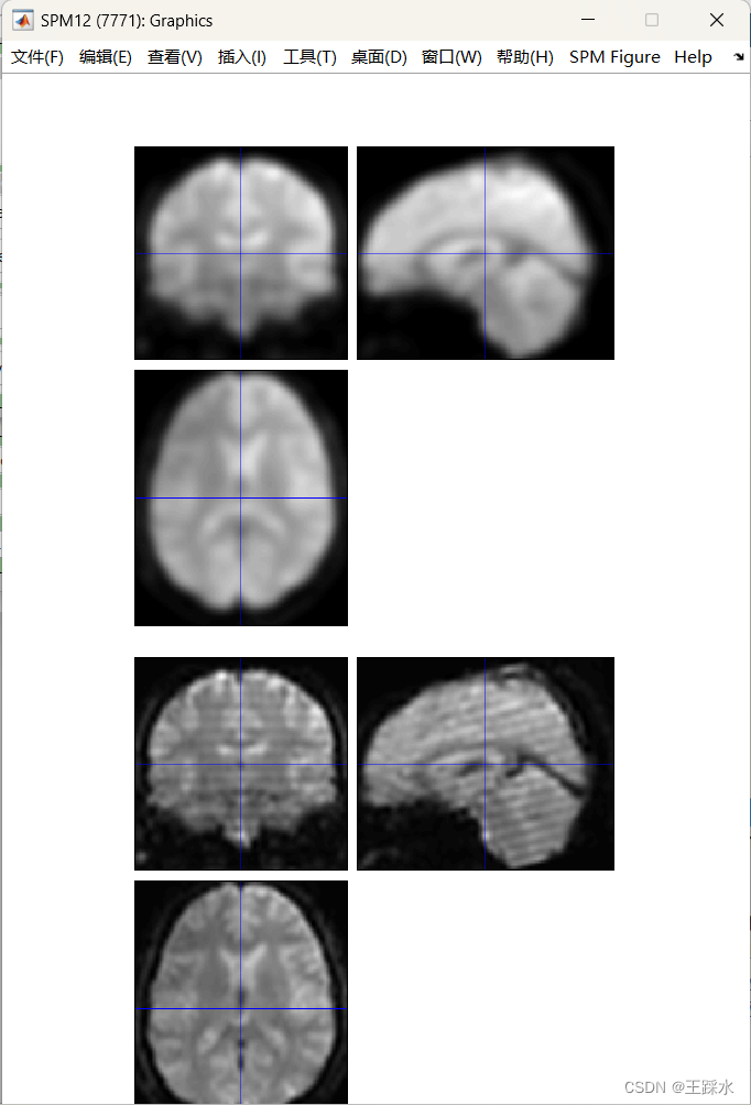 学习笔记 | 脑科学入门 | fmri 数据预处理_g, fnirs, fmri, dti, meg等脑影像数据的处理-CSDN博客