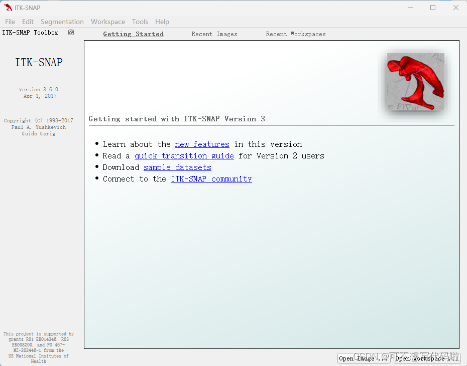 LiTS2017数据集介绍、下载与预处理_lits数据集下载-CSDN博客