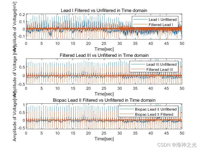 【心电信号ECG】心电信号处理（时域频域滤波 QRS检测 心率检测）【含Matlab源码 4306期】_心电信号处理系统设计-CSDN博客