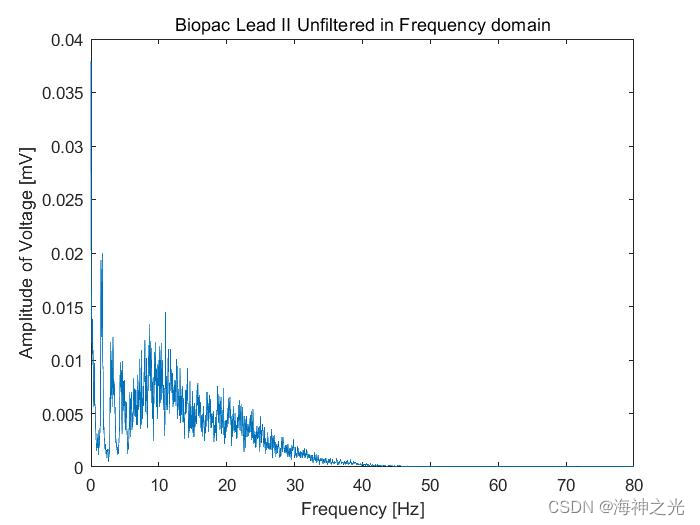 【心电信号ECG】心电信号处理（时域频域滤波 QRS检测 心率检测）【含Matlab源码 4306期】_心电信号处理系统设计-CSDN博客