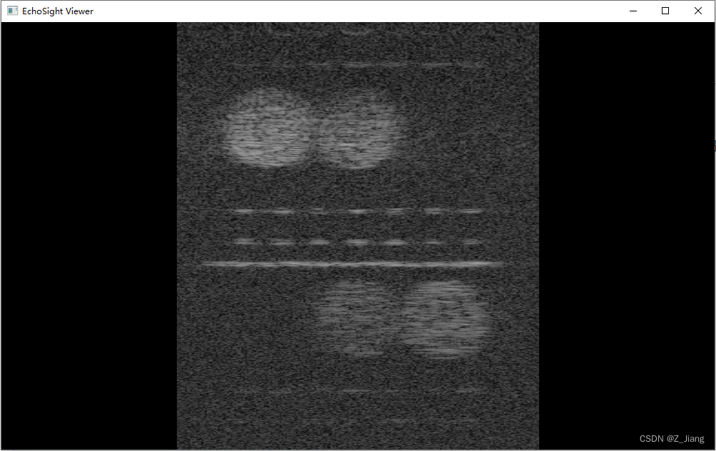 彩超框架EchoSight开发日志记录-CSDN博客