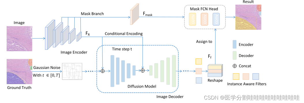 Enhancing gland segmentation in colon histology images using aninstance ...