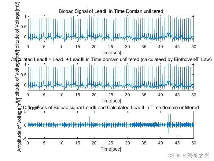 【心电信号ECG】基于matlab心电信号处理（时域频域滤波 QRS检测 心率检测）【含Matlab源码 4306期】_matlab心率数据处理-CSDN博客