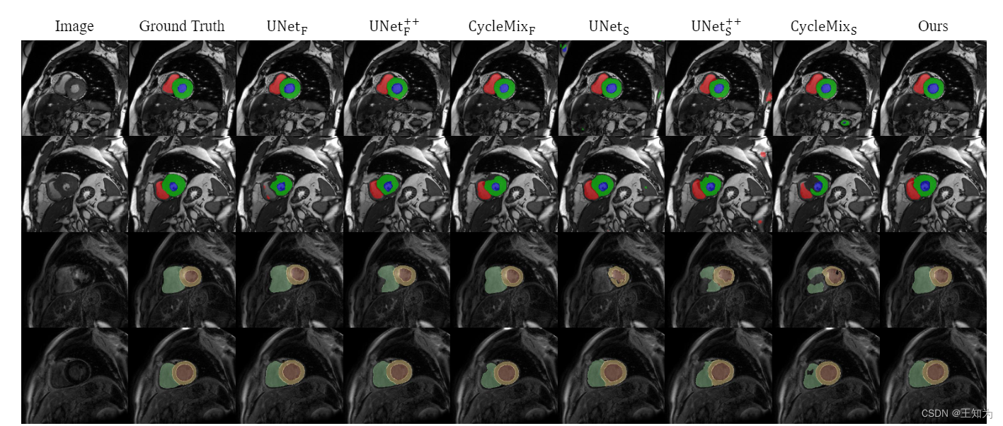 ScribFormer: Transformer Makes CNN Work Better for Scribble-based Medical Image Segmentation-CSDN博客
