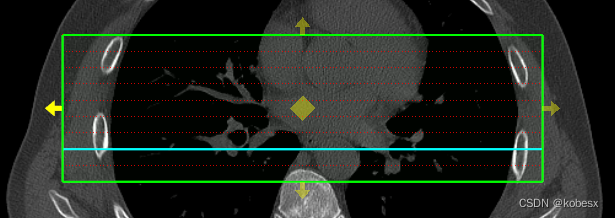 医学图像处理软件实战开发(QT + C++ + VTK) --- 3_qt医学软件-CSDN博客