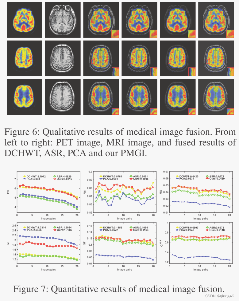 图像融合论文阅读：(PMGI)一种基于梯度与强度比例保持的快速统一图像融合网络_pmgi图像融合-CSDN博客