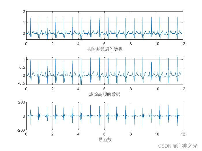 【心电信号ECG】心电信号P,Q,R,S,T波位置标记（读取人体心跳数据）【含Matlab源码 4344期】_ecg pqrst-CSDN博客