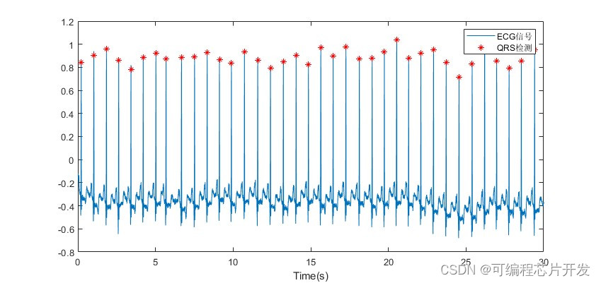 基于心电信号时空特征的QRS波检测算法matlab仿真_qrs波心拍定位算法-CSDN博客