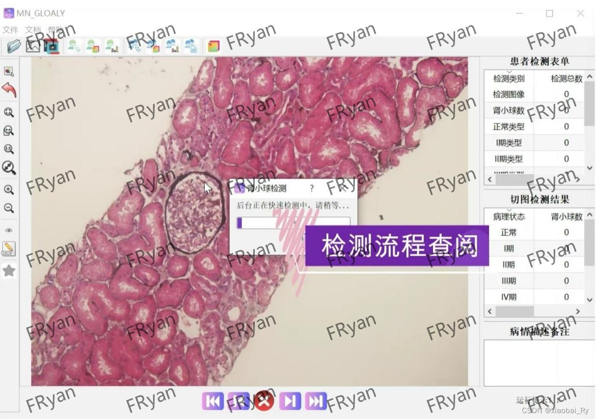 【qt开发】基于pyqt5开发的标注软件基于qt编写手动标注软件 Csdn博客