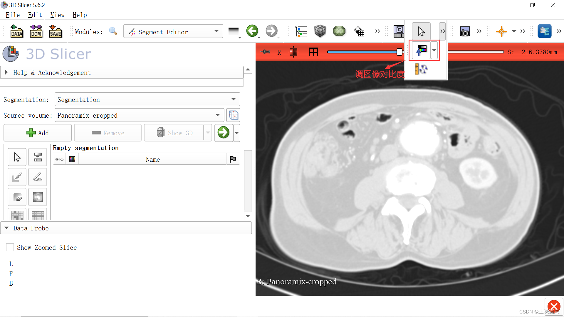3D Slicer的学习（一）（Win10环境）_3d slicer 及dicomworks-CSDN博客