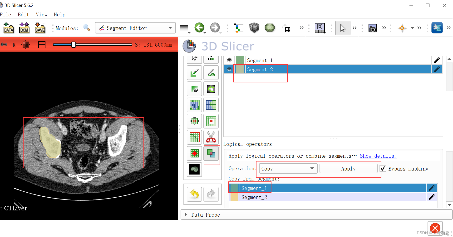 3D Slicer的学习（二） 图像的分割_3dslicer窗宽窗位-CSDN博客