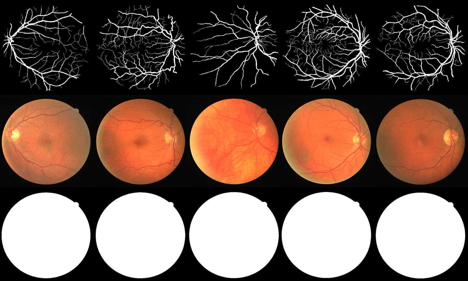 【图像分割】【深度学习】unet Pytorch代码 数据预处理模块解析unet源码pytorch Csdn博客