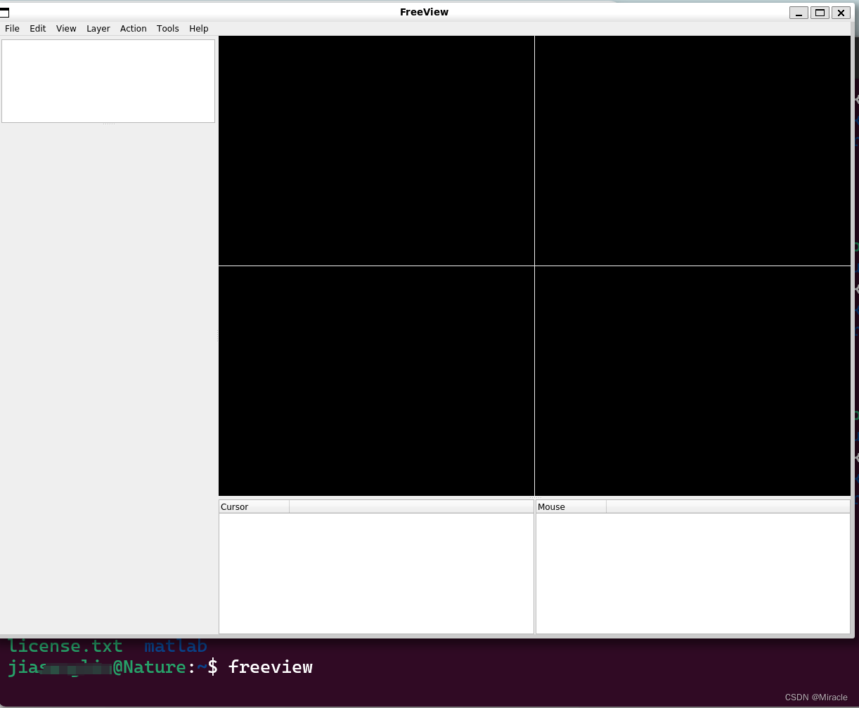 在Windows上运行Freesurfer的简易方法（基于WSL2）_freesurfer wsl-CSDN博客