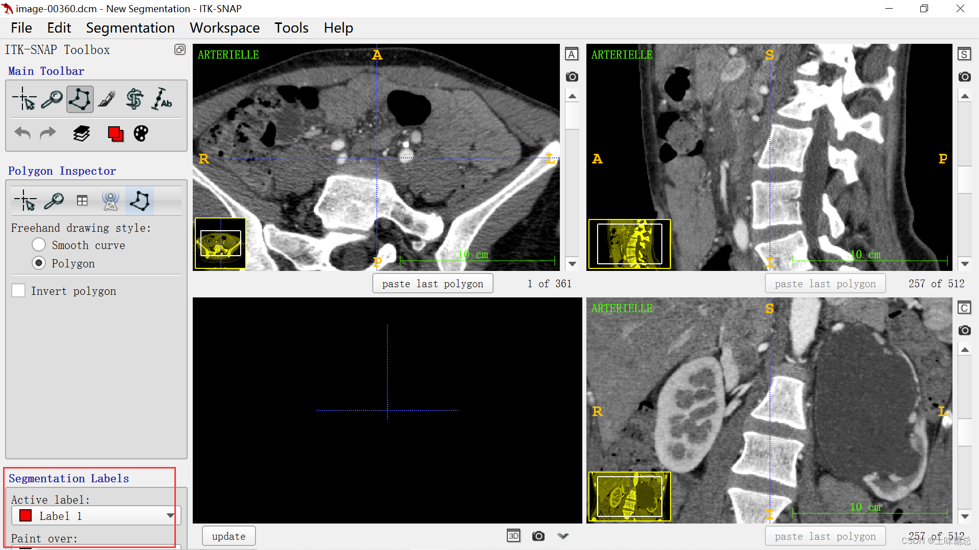 ITK-SNAP的学习（二）感兴趣区域的勾画-CSDN博客