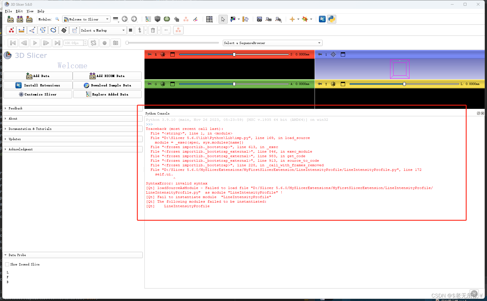 3DSlicer中自己创建一个Extension项目（前篇）_3d slicer拓展-CSDN博客