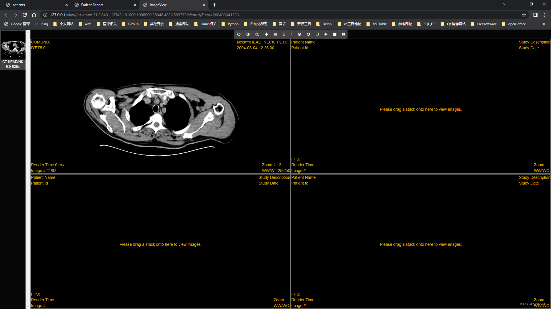 【2024-01-15 第三次更新版】简易PACS系统模拟搭建（仅供参考学习）_pacs c++开源源码下载-CSDN博客