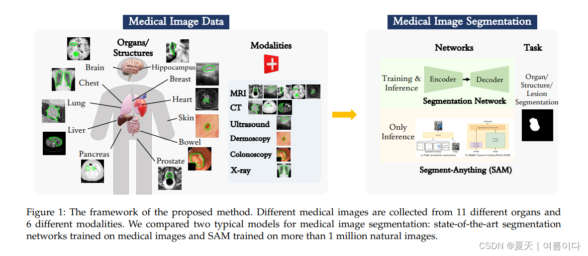 CV | SAM在医学影像上的模型调研【20240223更新版】_medsam 2024-CSDN博客
