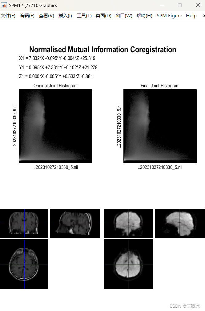 学习笔记 | 脑科学入门 | fmri 数据预处理_g, fnirs, fmri, dti, meg等脑影像数据的处理-CSDN博客
