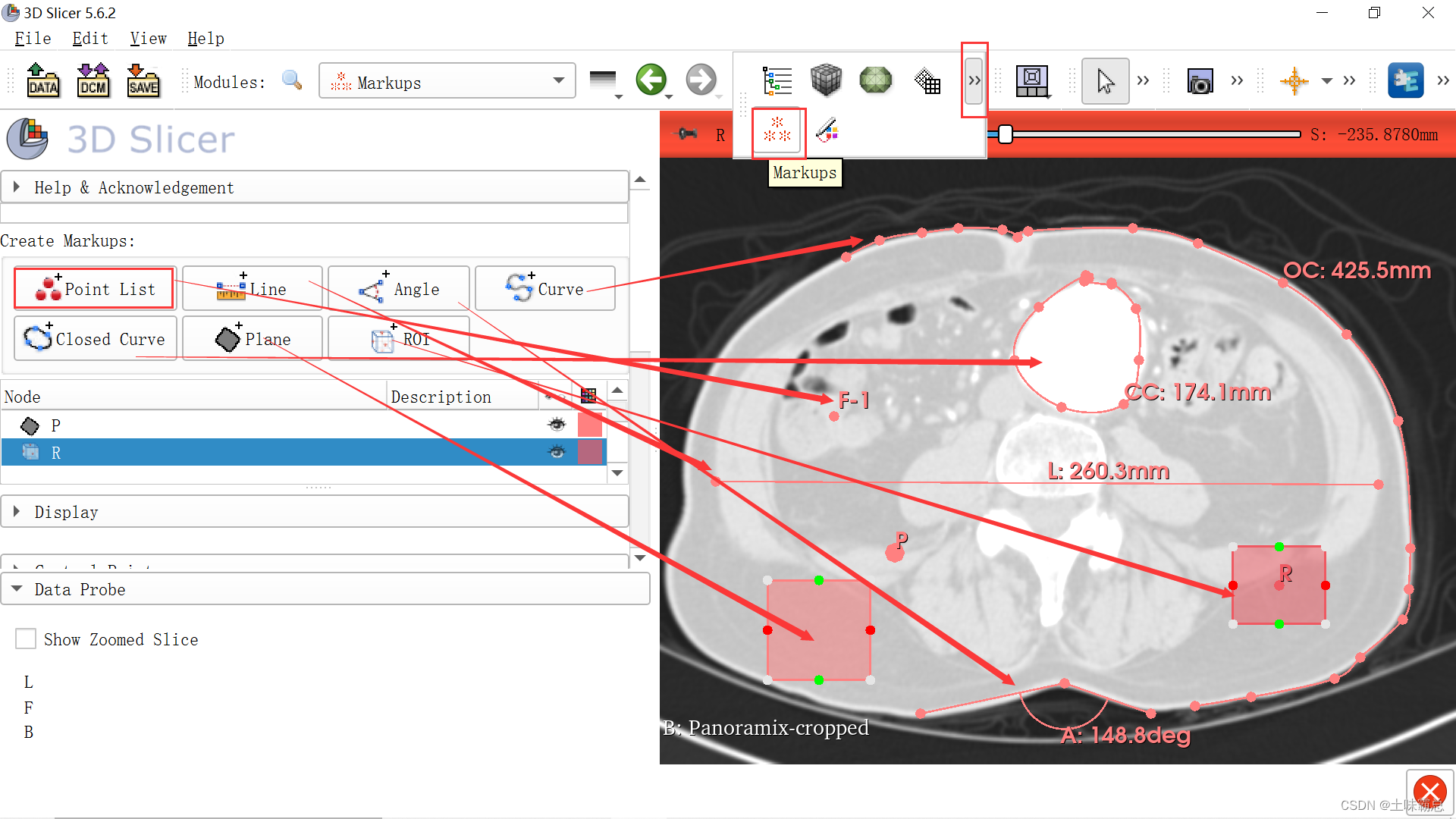 3D Slicer的学习（一）（Win10环境）_设置3d slicer python环境设置-CSDN博客