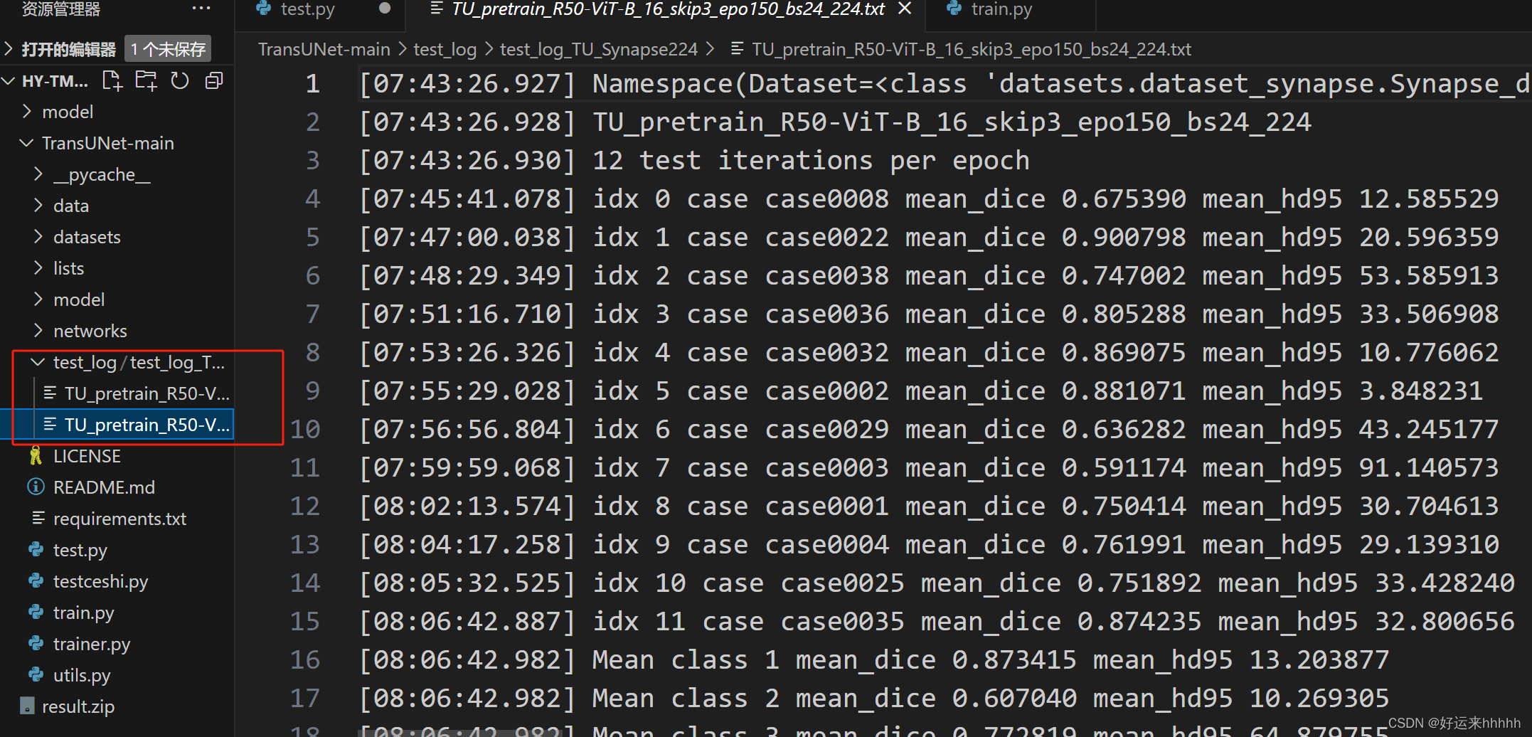 Transunet复现_transunet复现测试出错-CSDN博客