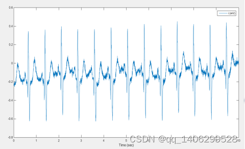 基于深度学习的ECG疾病识别研究_深度学习ecg-CSDN博客