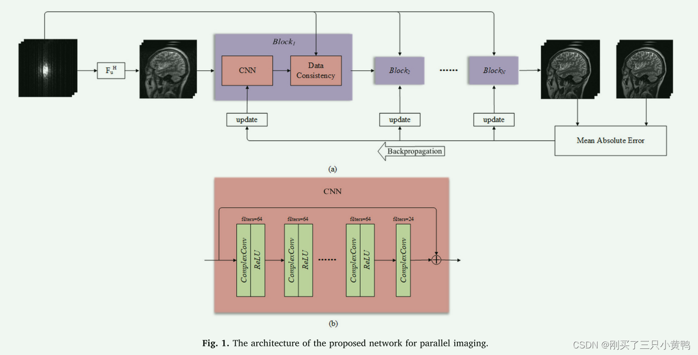 DeepcomplexMRI: Exploiting deep residual network for fast parallel MR imaging with complex ...
