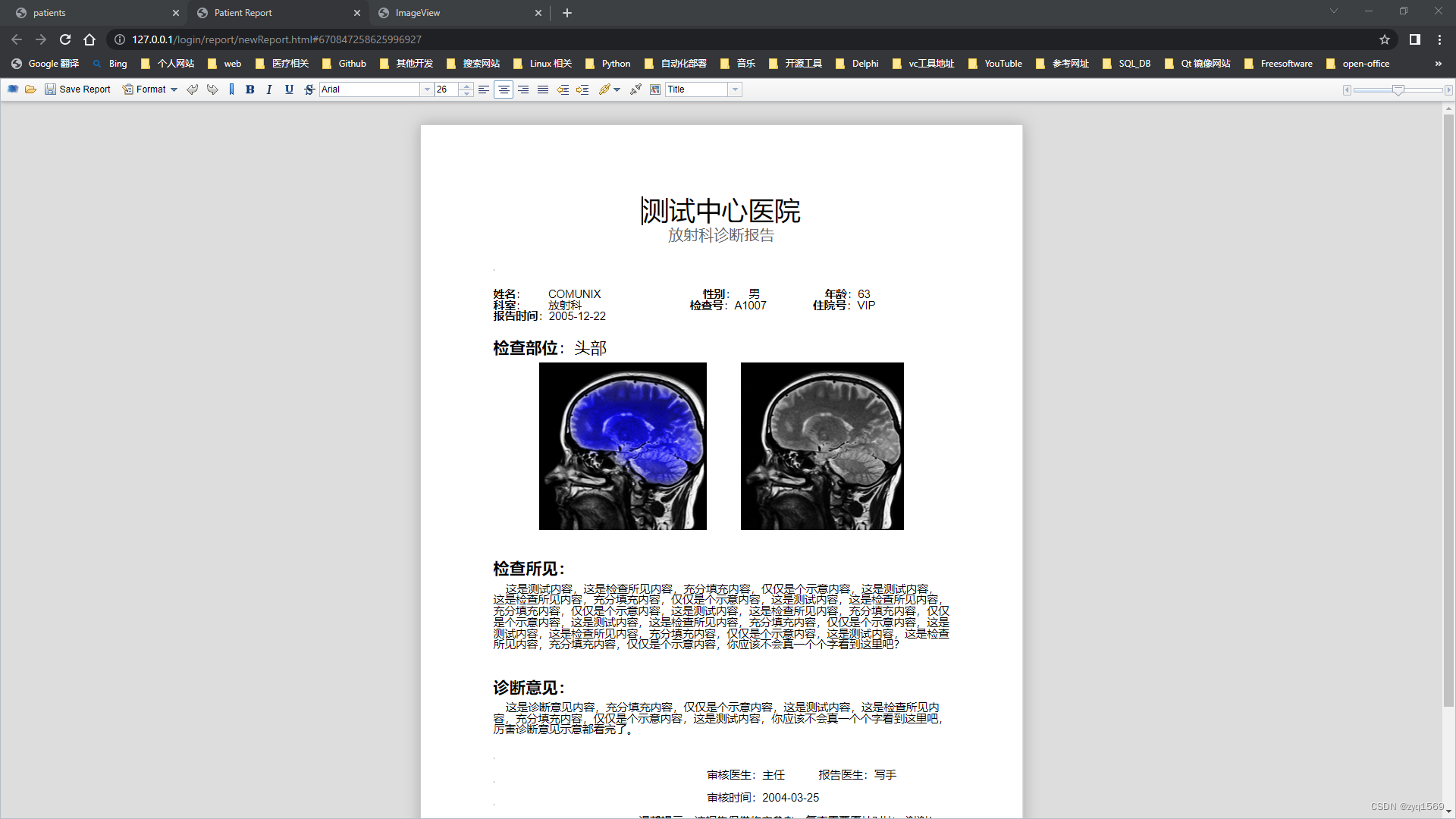 【2024-01-15 第三次更新版】简易PACS系统模拟搭建（仅供参考学习）_pacs c++开源源码下载-CSDN博客