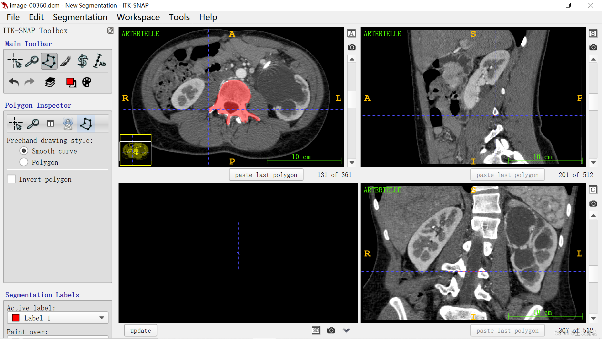 ITK-SNAP的学习（二）感兴趣区域的勾画-CSDN博客
