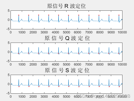 基于深度学习的ECG疾病识别研究_深度学习ecg-CSDN博客