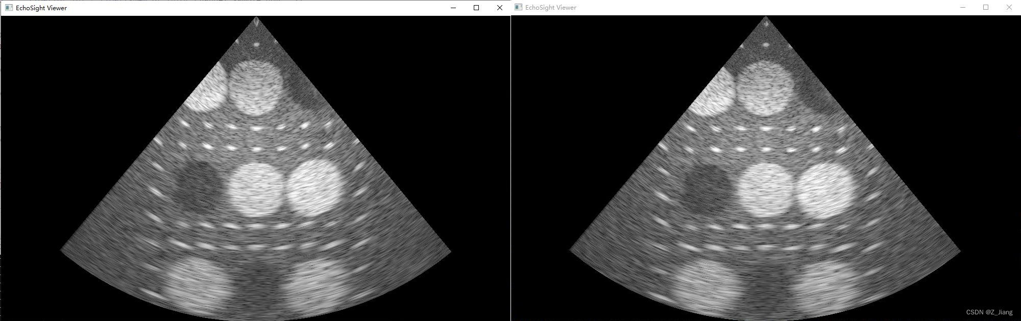 彩超框架EchoSight开发日志记录-CSDN博客