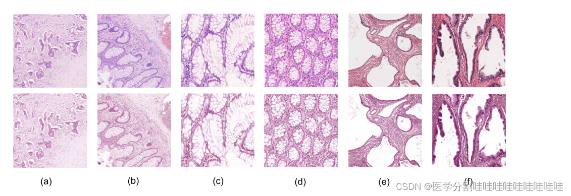 Enhancing gland segmentation in colon histology images using aninstance ...