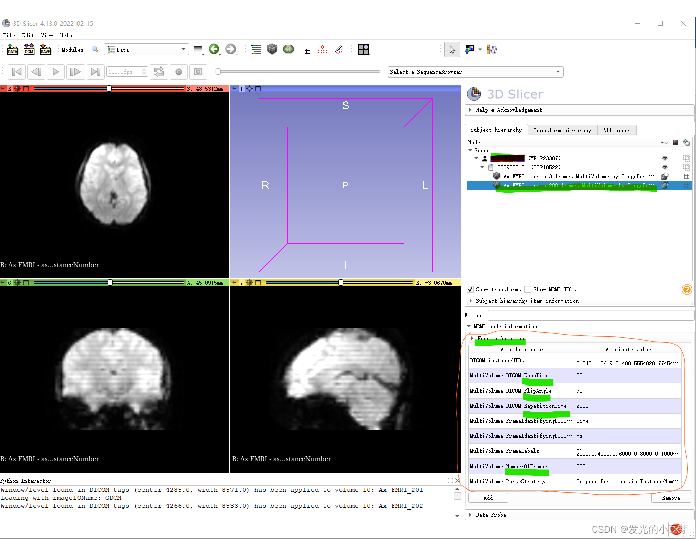 3D Slicer打开 fMRI 影像并查看扫描参数_fmri查看属性-CSDN博客