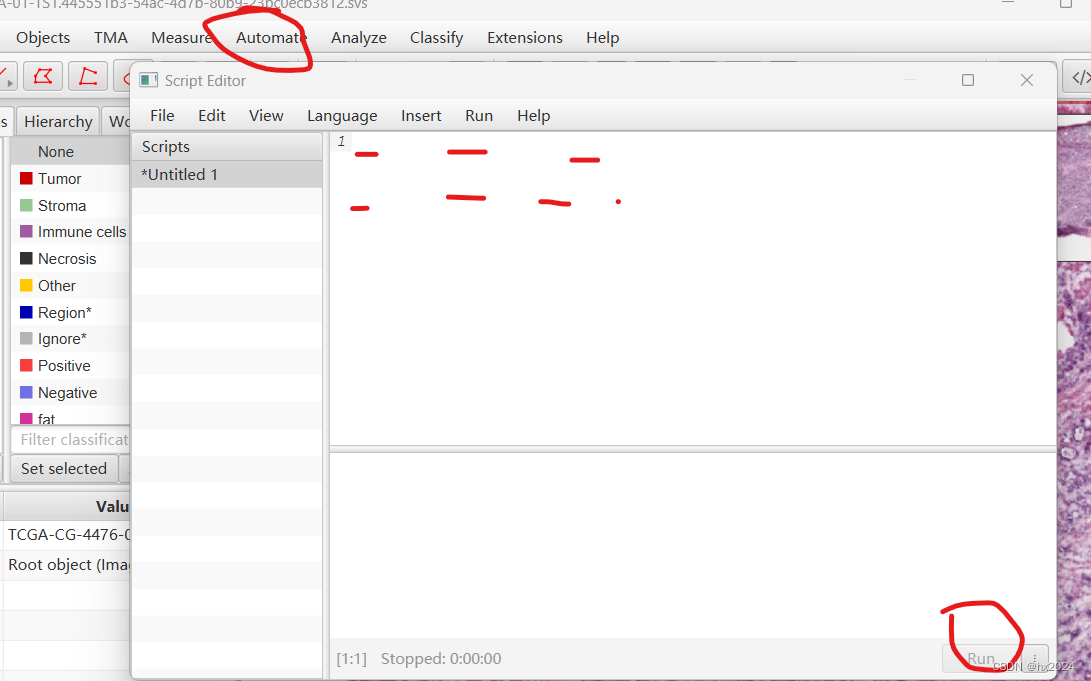 QuPath病理流程学习 ③ IHC、H&E （WSI的处理）实战_qupath0.5下载-CSDN博客