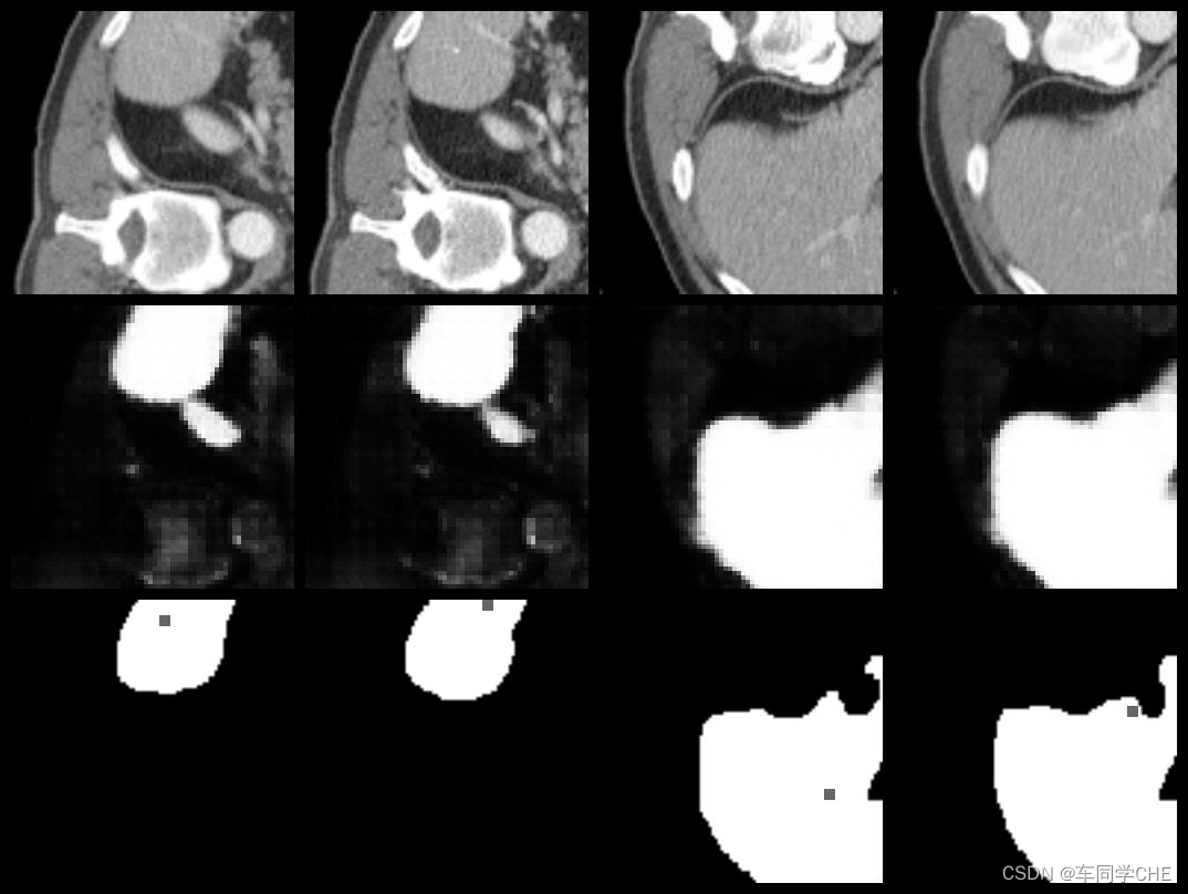 论文代码复现之Medical SAM Adapter (Junde Wu version)_runtimeerror(f"applying transform {transform}") fr ...