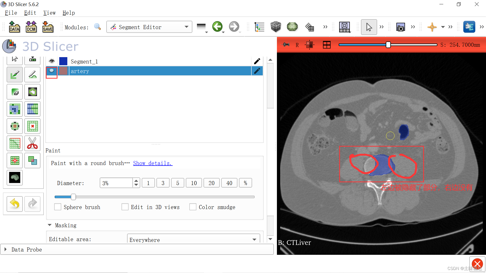 3D Slicer的学习（二） 图像的分割_3dslicer窗宽窗位-CSDN博客