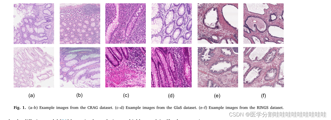 Enhancing gland segmentation in colon histology images using aninstance ...