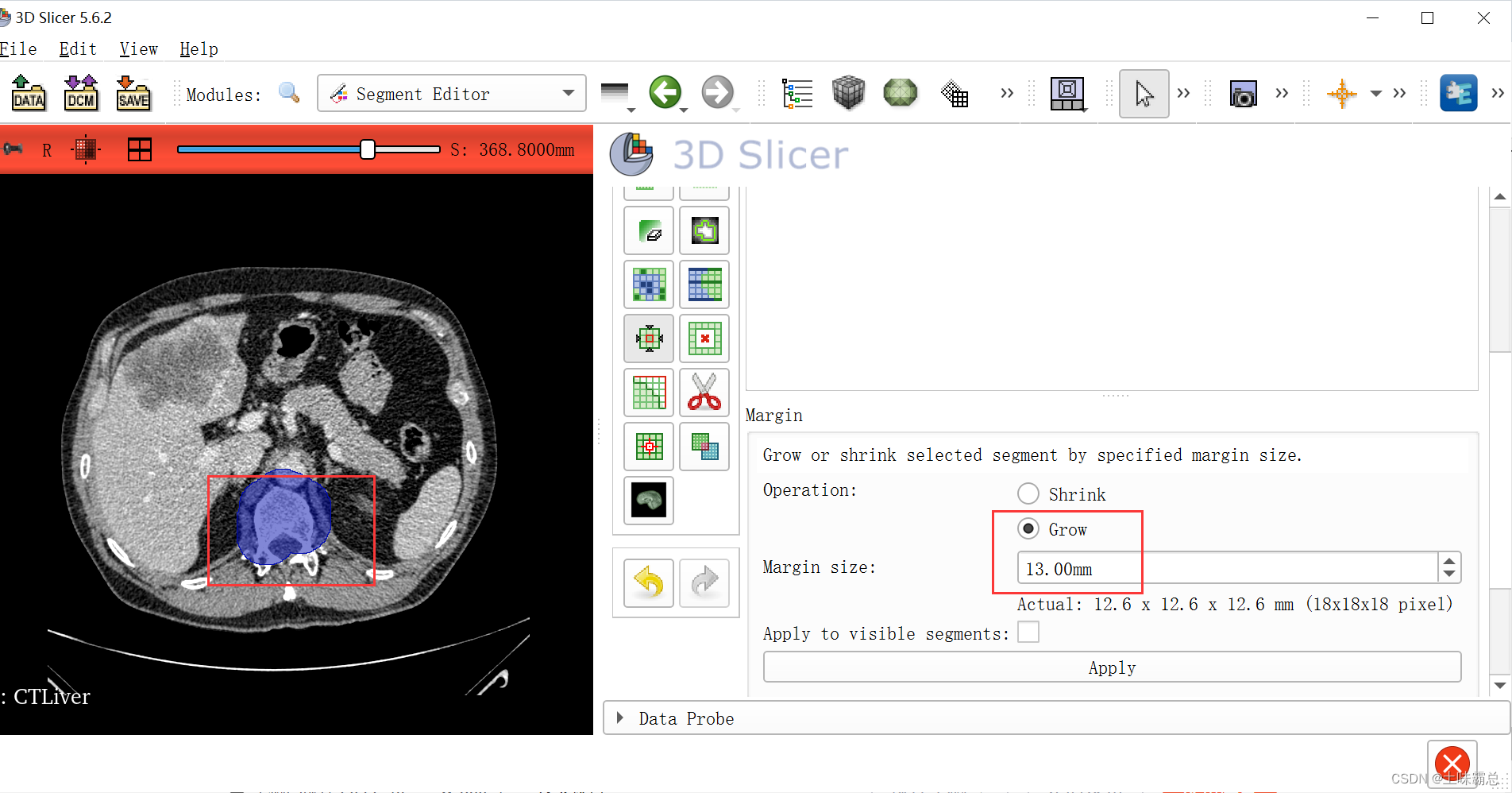 3D Slicer的学习（二） 图像的分割_3dslicer裁剪-CSDN博客