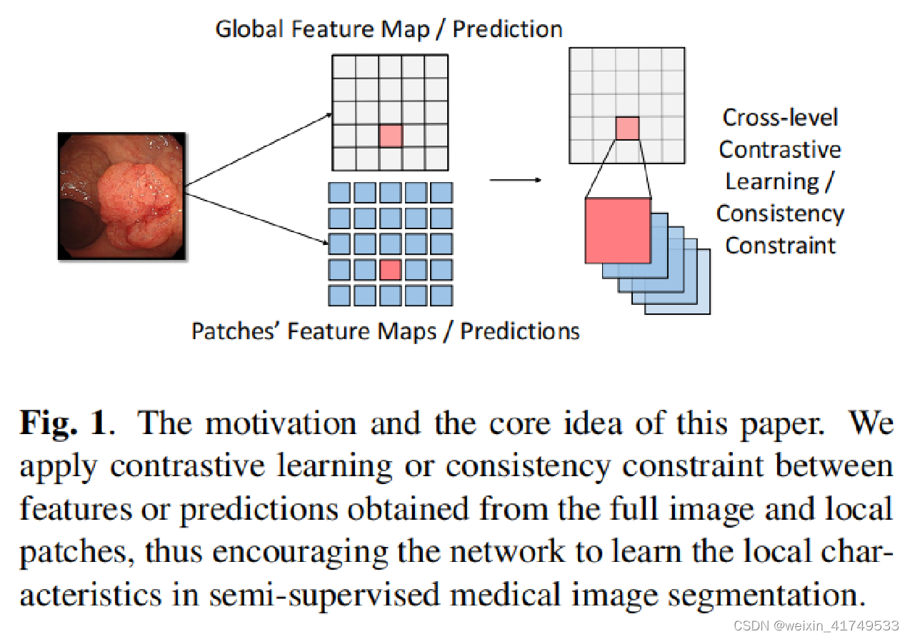 Cross-level Contrastive Learning and Consistency Constraint for Medical Image Segmentation-CSDN博客