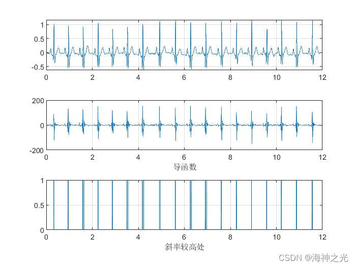 【心电信号ECG】基于matlab心电信号P,Q,R,S,T波位置标记（读取人体心跳数据）【含Matlab源码 4344期】_心电图pqrst关键点标注训练数据-CSDN博客