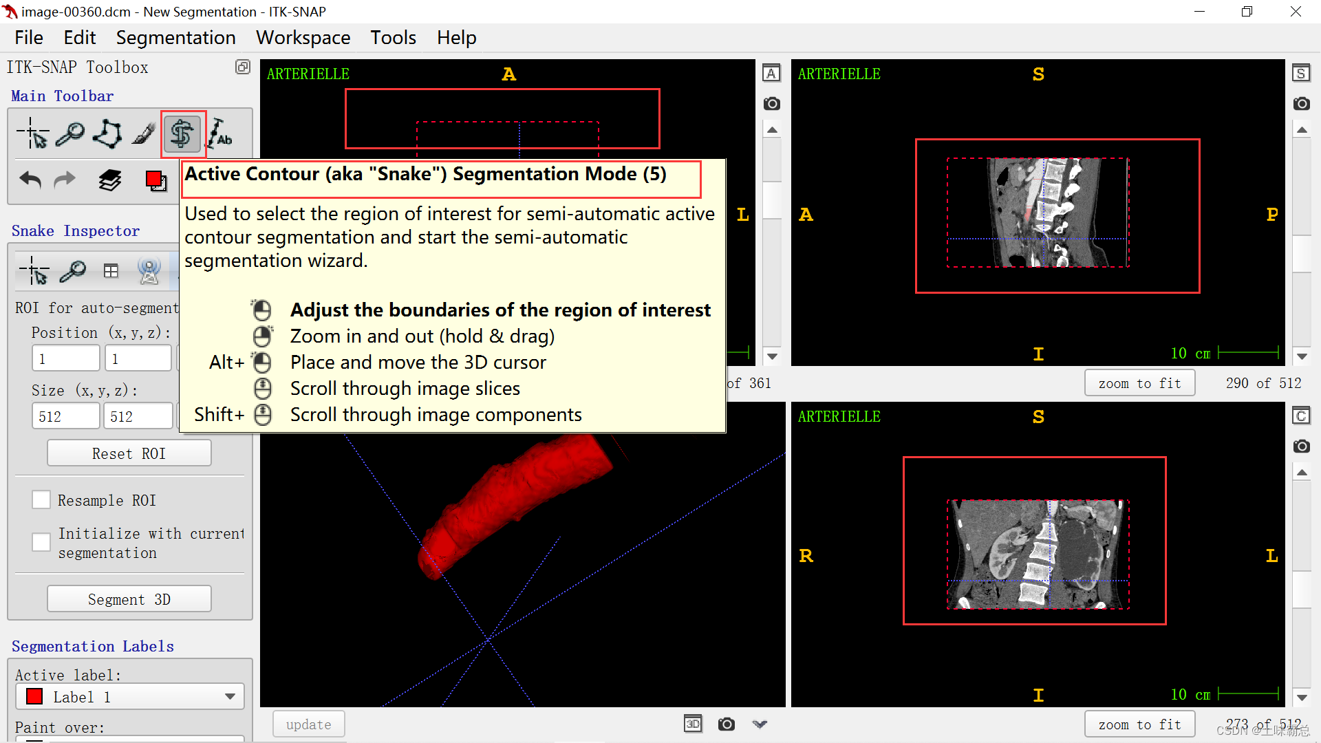 ITK-SNAP的学习（二）感兴趣区域的勾画-CSDN博客