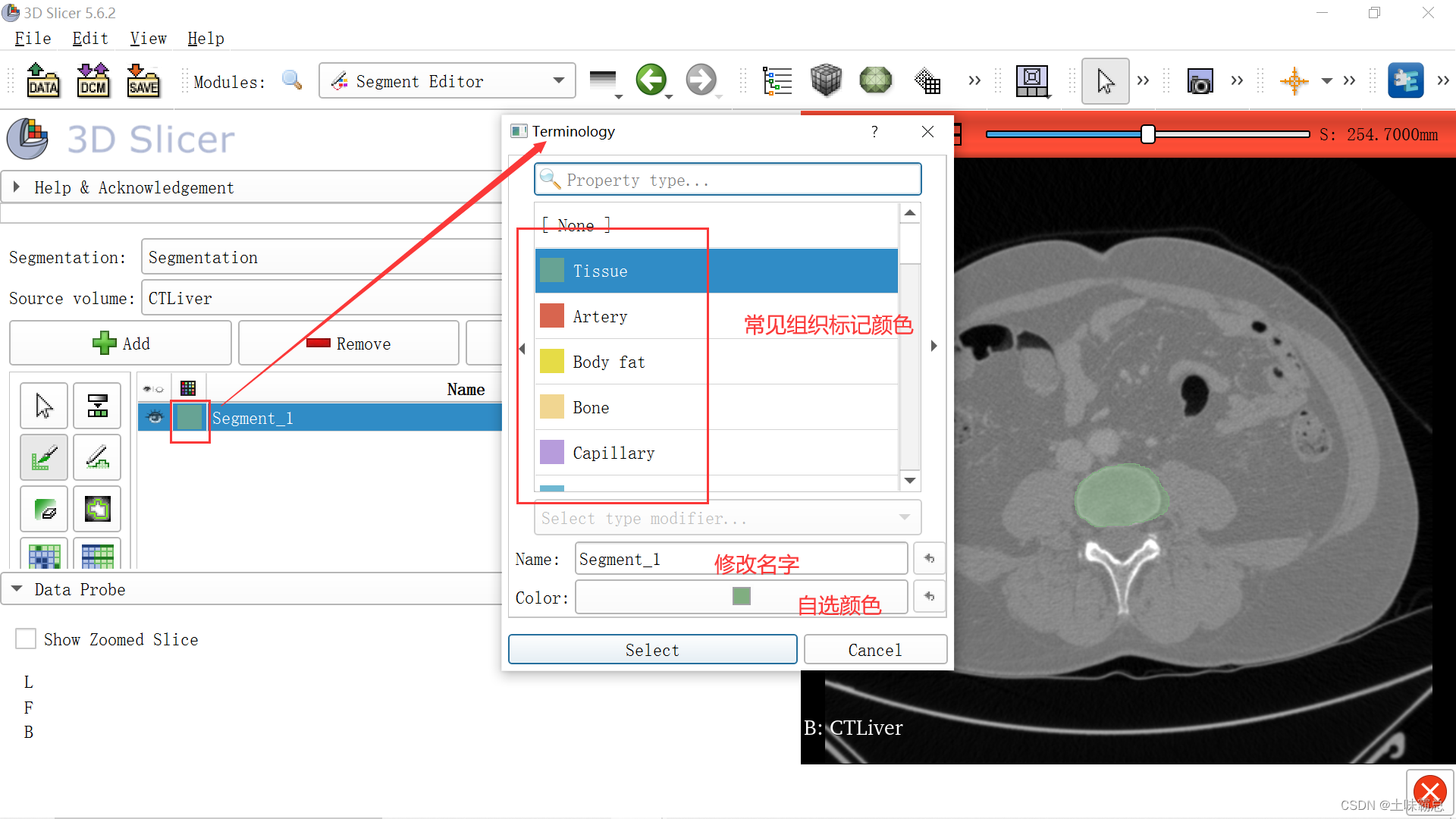 3D Slicer的学习（二） 图像的分割_3dslicer裁剪-CSDN博客