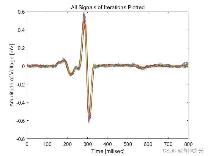 【心电信号ECG】基于matlab心电信号处理（时域频域滤波 QRS检测 心率检测）【含Matlab源码 4306期】_matlab心率数据处理-CSDN博客