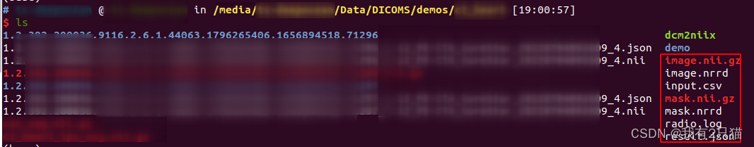 【组学计算 pyradiomics】可算是玩明白了!!!_pyradiomics --mode-CSDN博客