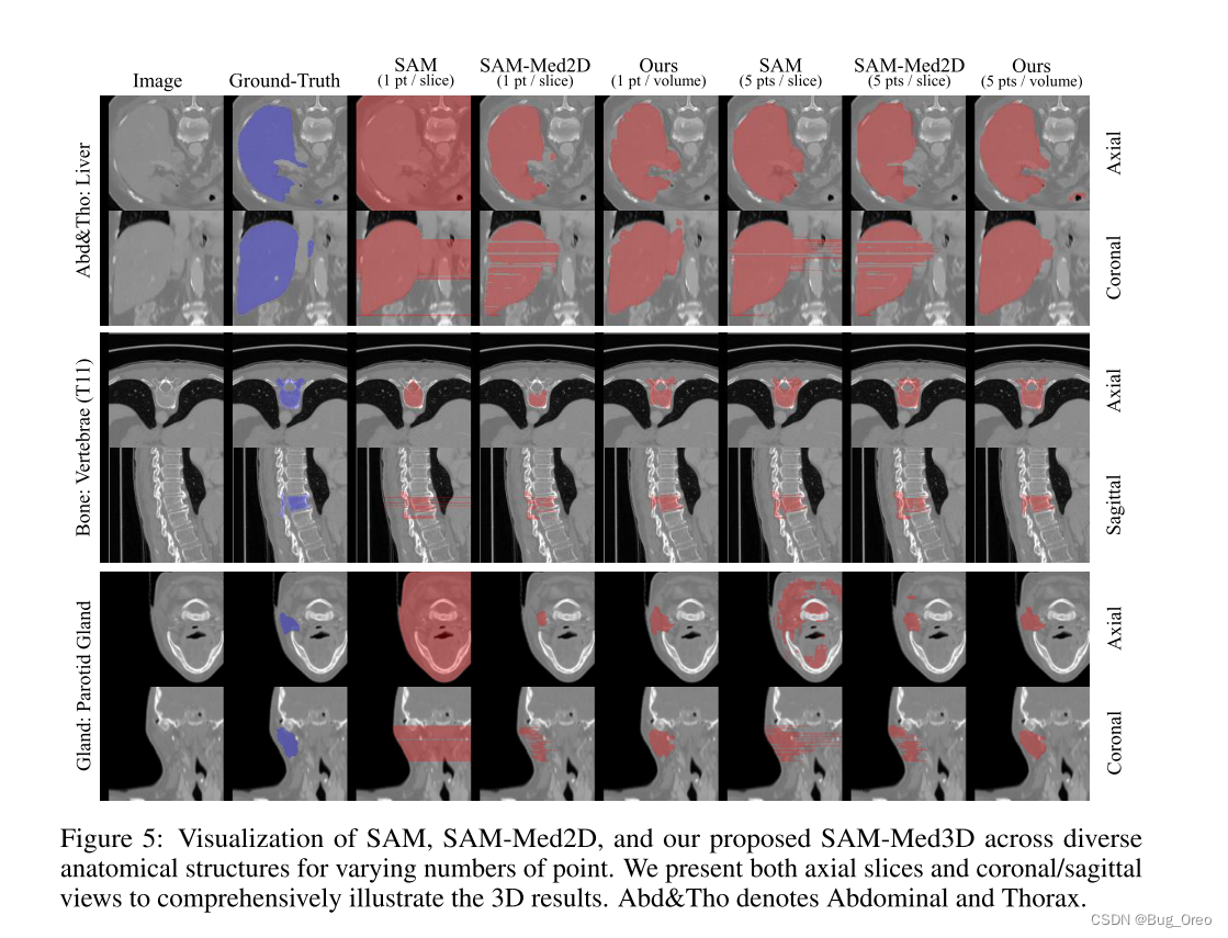 SAM-Med3D论文阅读笔记-CSDN博客